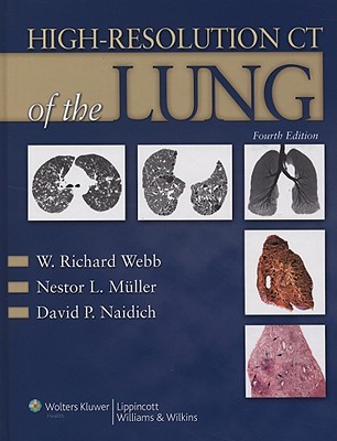 Fundamentals Of High-resolution Lung Ct - fasrdata